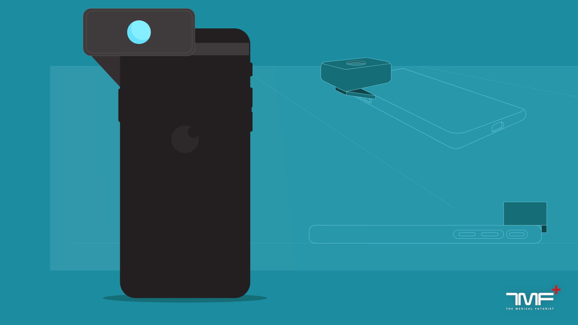 Handheld Retinal Camera As An Eye For Innovation – D-EYE Review - The ...